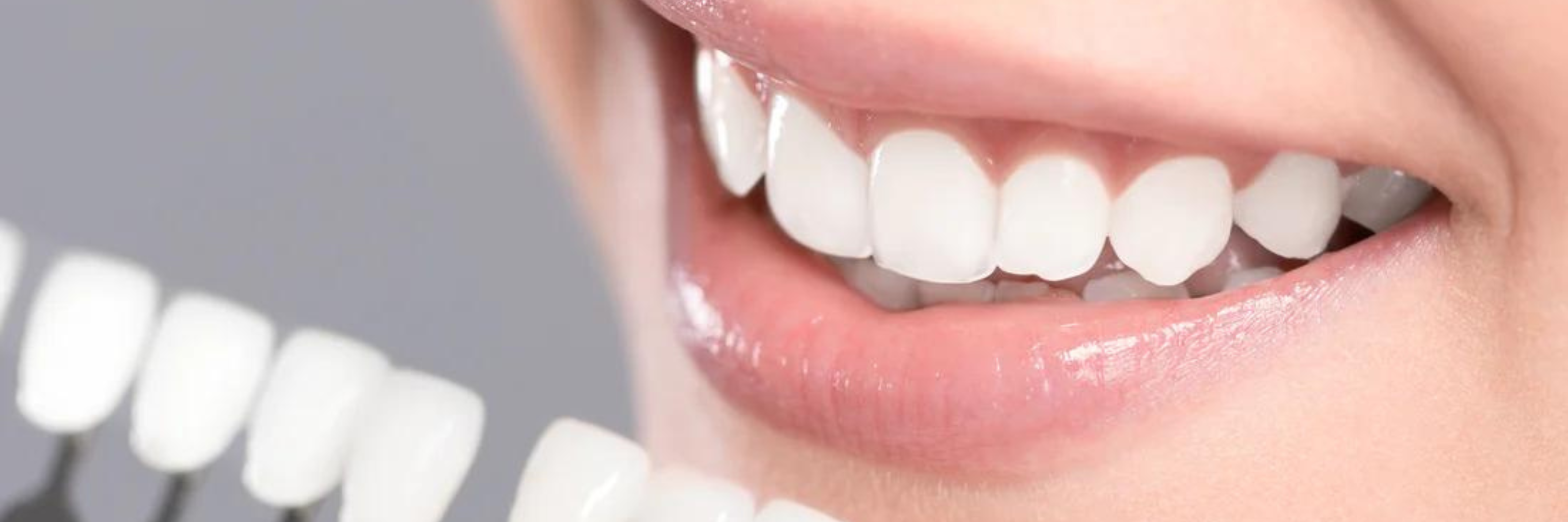 Góð ráð fyrir hvítari tennur | Fotia.is